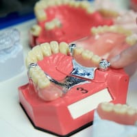 Zahnprothese - festsitzend oder herausnehmbare Teil- und Vollprothesen