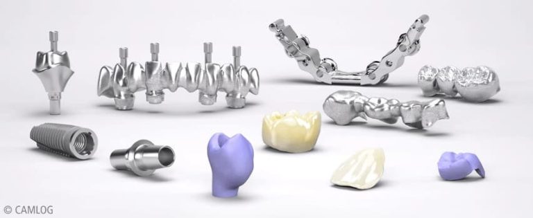 Alginat | Dentallexikon » Zahnarzt Herne